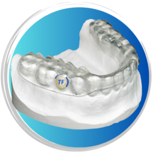 Splint - True Function Laboratory