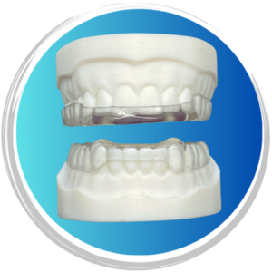 Splint - True Function Laboratory