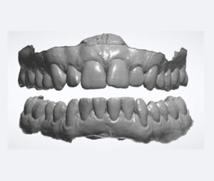 Intraoral Scans - True Function Laboratory