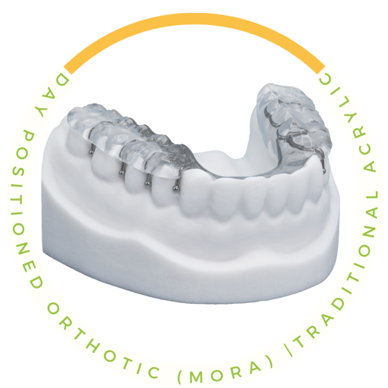 Splint - True Function Laboratory